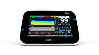 Conox